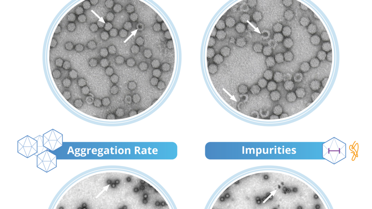 TEM Testing for Virus & vector characterization - ViruSure